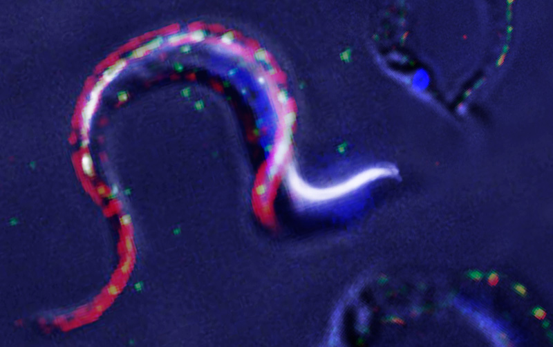 Parasite Research Unravels Clues for Possible Infectious Disease ...