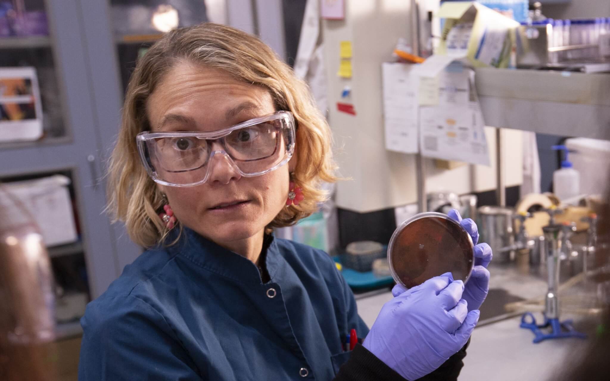 Study Shows Multidrug-Resistance in Leukemia Patient Receiving ...